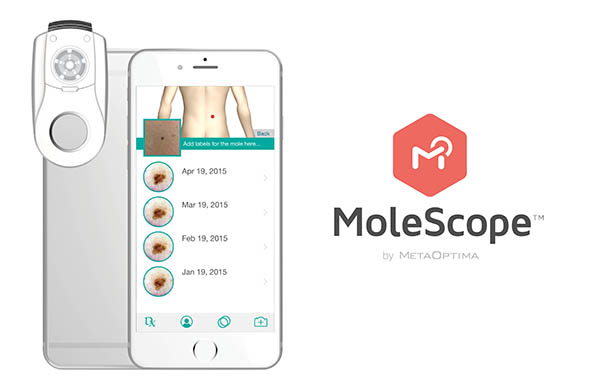 Media Resources | MoleScope™